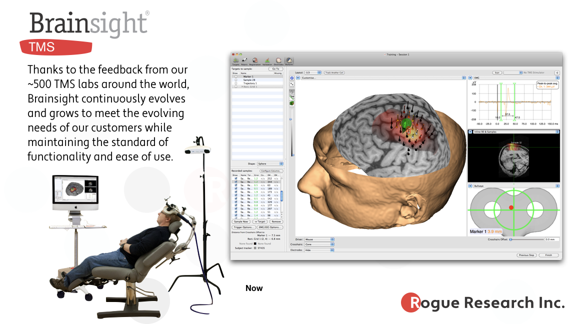 TMS - Rogue Research